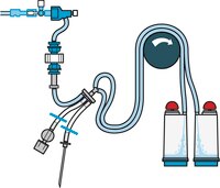 Steritest™ NEO Devices for Products Without Antimicrobial Agents ...